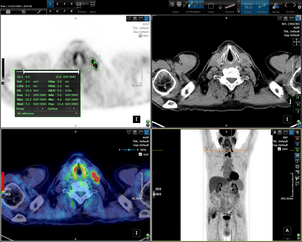 PTCT - Biotronics3D | 3Dnet